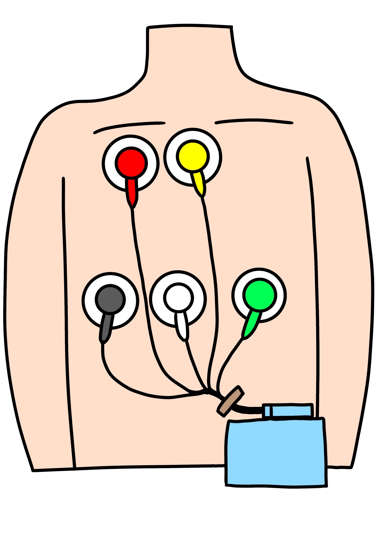 Electrocardiograph electrodes (electrodes for ECG)