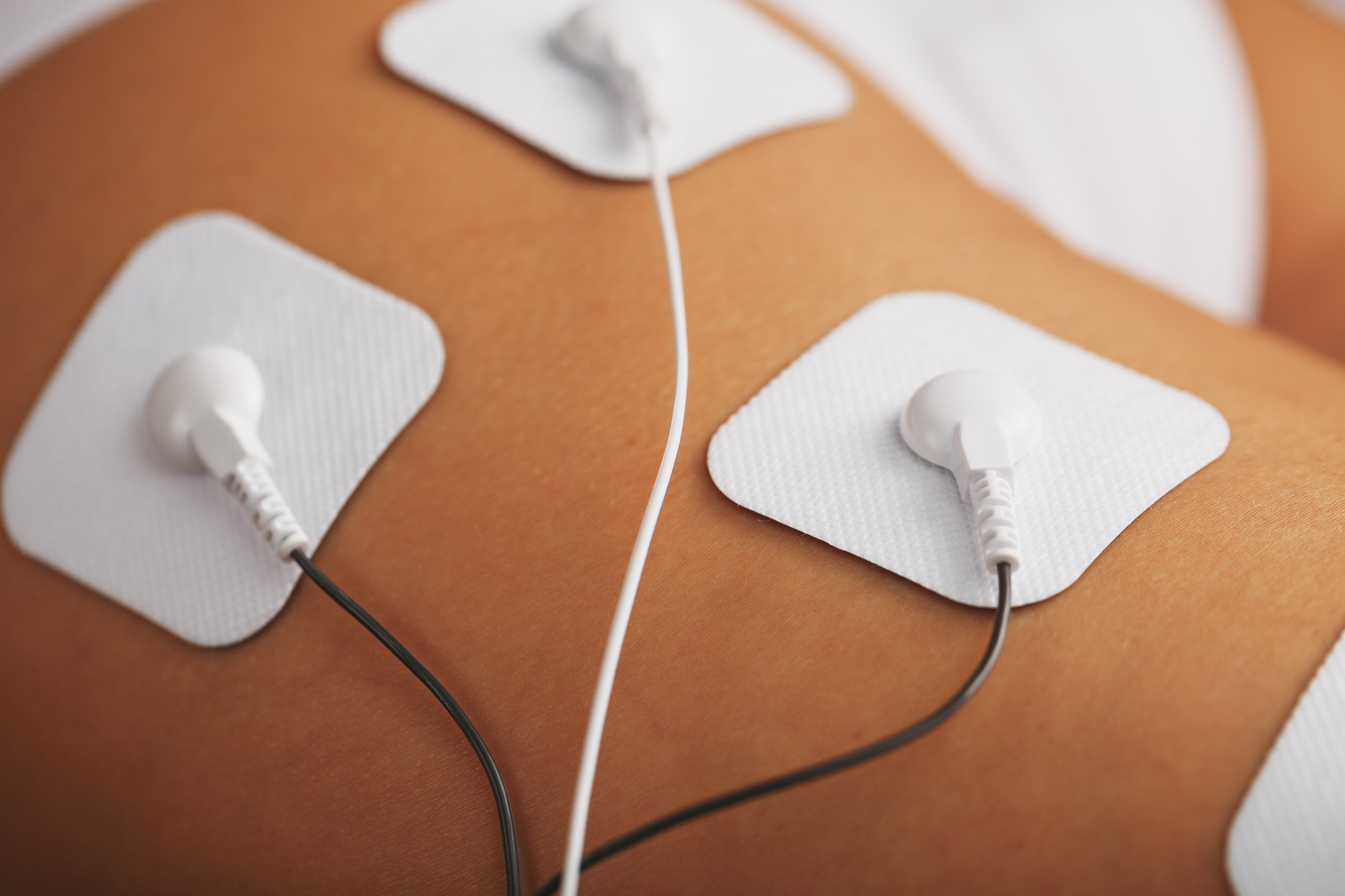 Electromyocardiograph electrodes (electrodes for EMG)